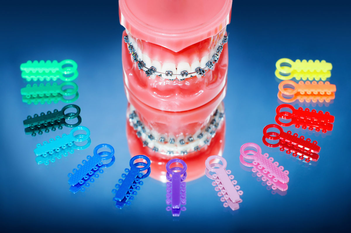 How Do Braces Fix Your Teeth? - Baum Orthodontics